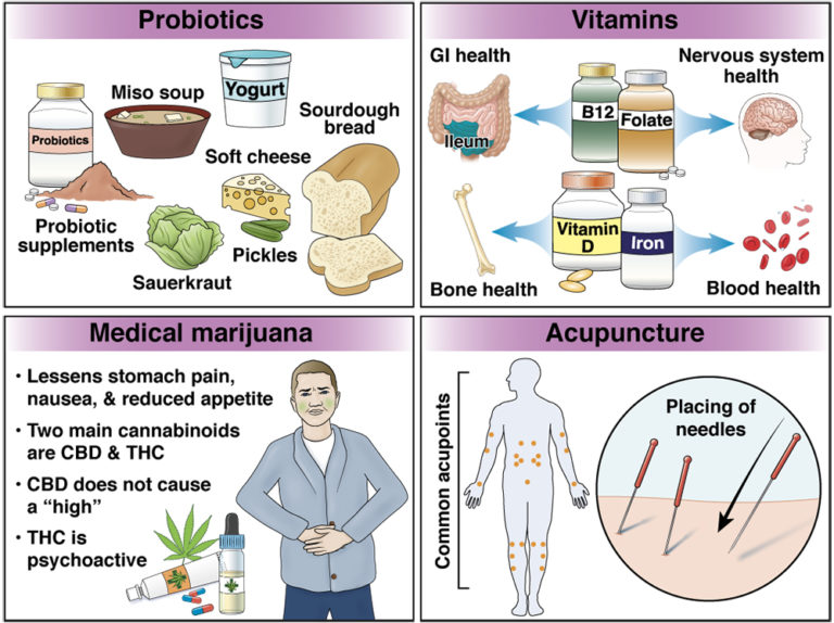 Inflammatory bowel disease (IBD) - AGA GI Patient Center