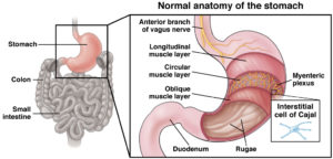 Gastroparesis - AGA GI Patient Center